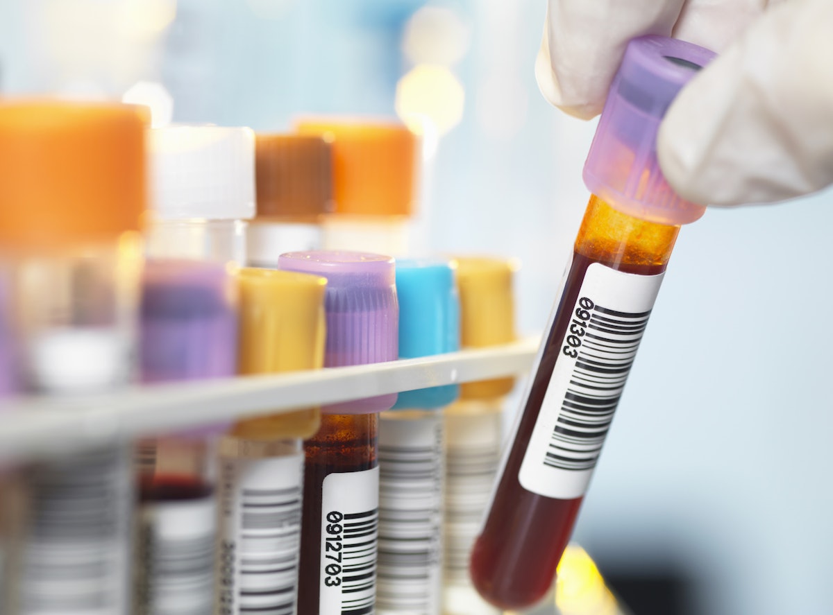 Modest Growth Predicted for IVD Market | Healthcare Packaging