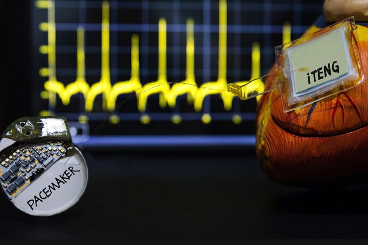 New Heart-Powered Pacemaker Powers the Heart. Wait, What? | Healthcare ...