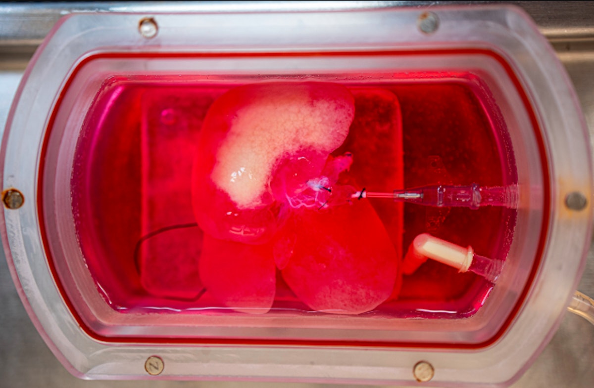 Researchers are Growing Mini Livers for Testing | Healthcare Packaging