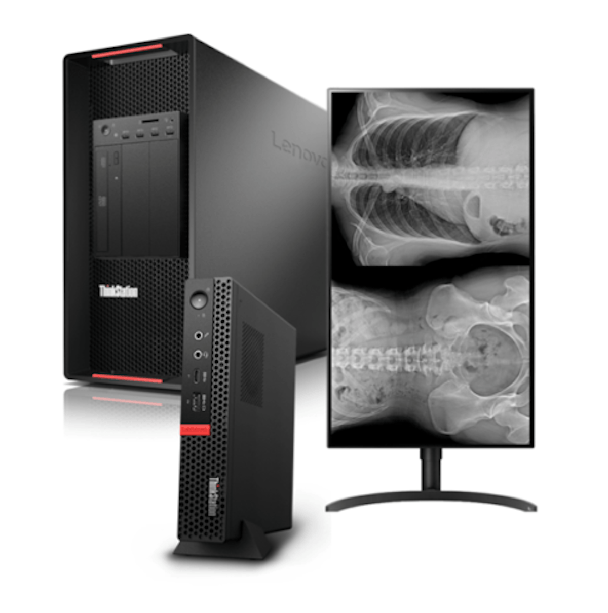 Advanced Medical Imaging OEM Offering Combines Lenovo Workstations and ...