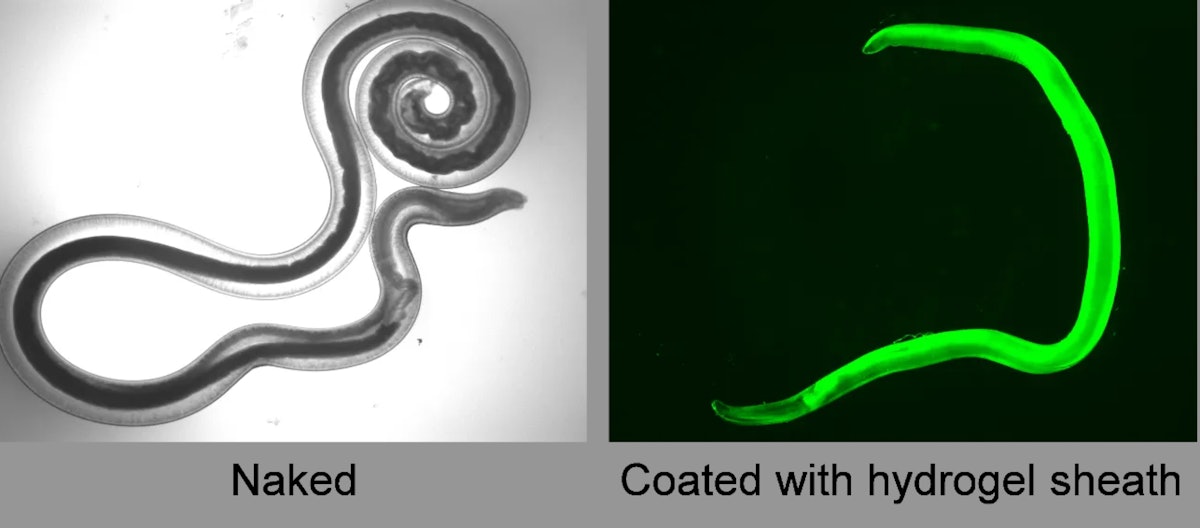 Scientists Are Equipping Worms With Cancer-Killing Drugs | Healthcare ...