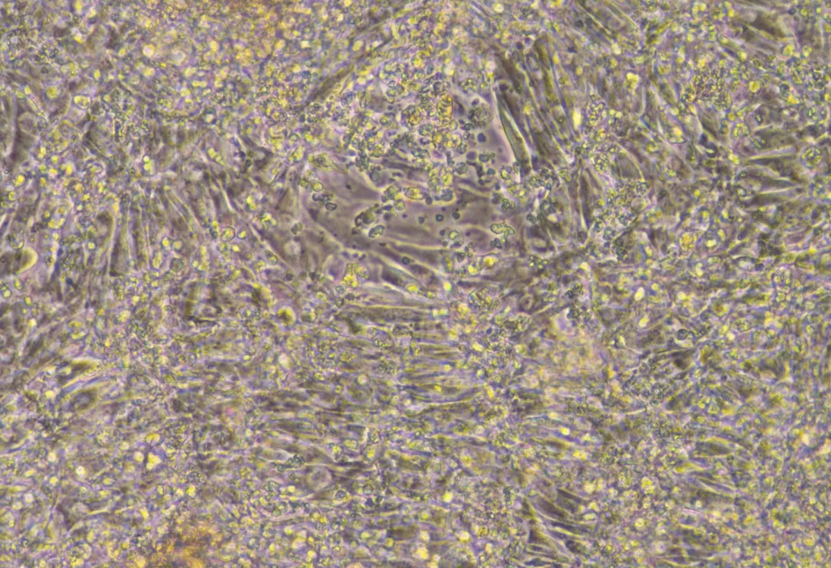 New Stem Cell Therapy Shows Promise for Heart Failure Patients | Healthcare Packaging